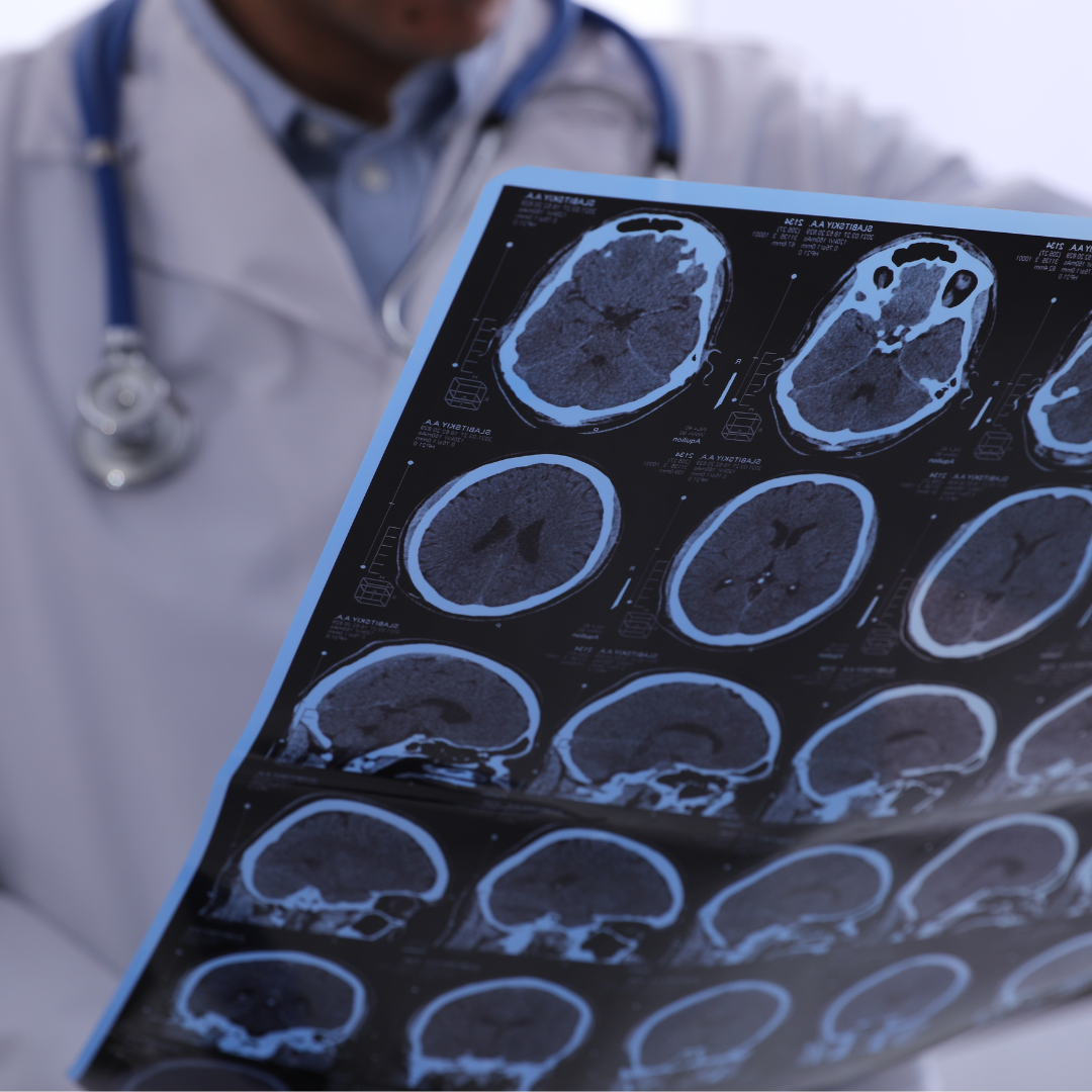 Interview with Prof Götz Thomalla, University Medical Center Hamburg ...