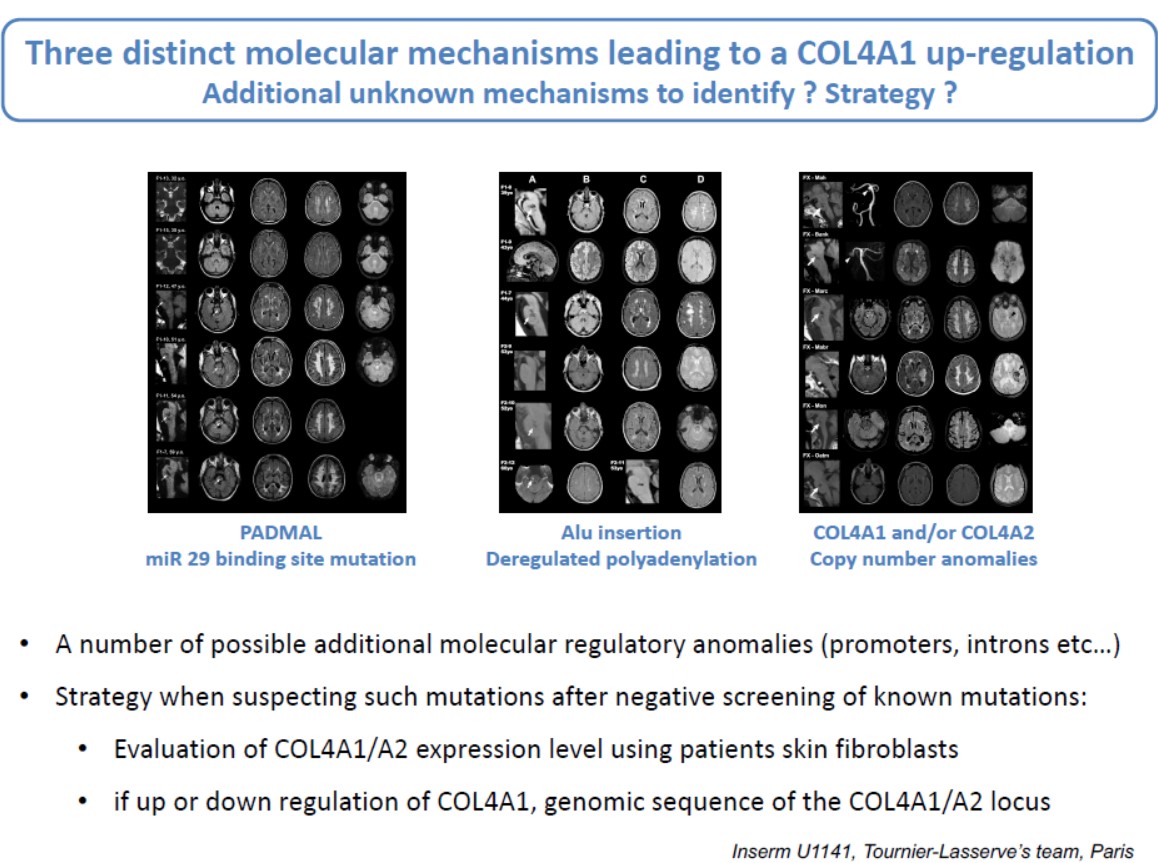 ESSW - Session 5 - Too much, too young - European Stroke Organisation