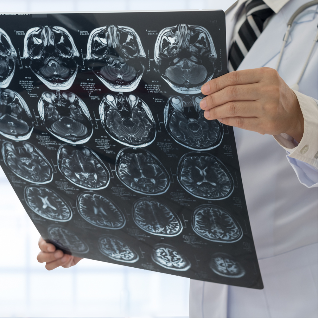 Exploring the OPTIMAS Trial: A New Perspective on Anticoagulation ...