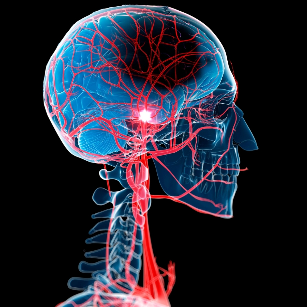 Home- European Stroke Organisation