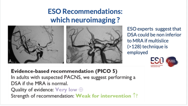 PACNS – clinical perspective and first international multidisciplinary ...